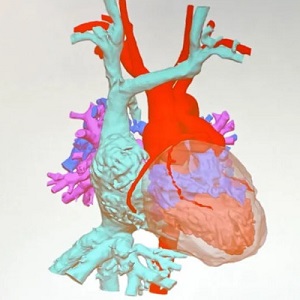 isicad: 7 000 000 пользователей SOLIDWORKS